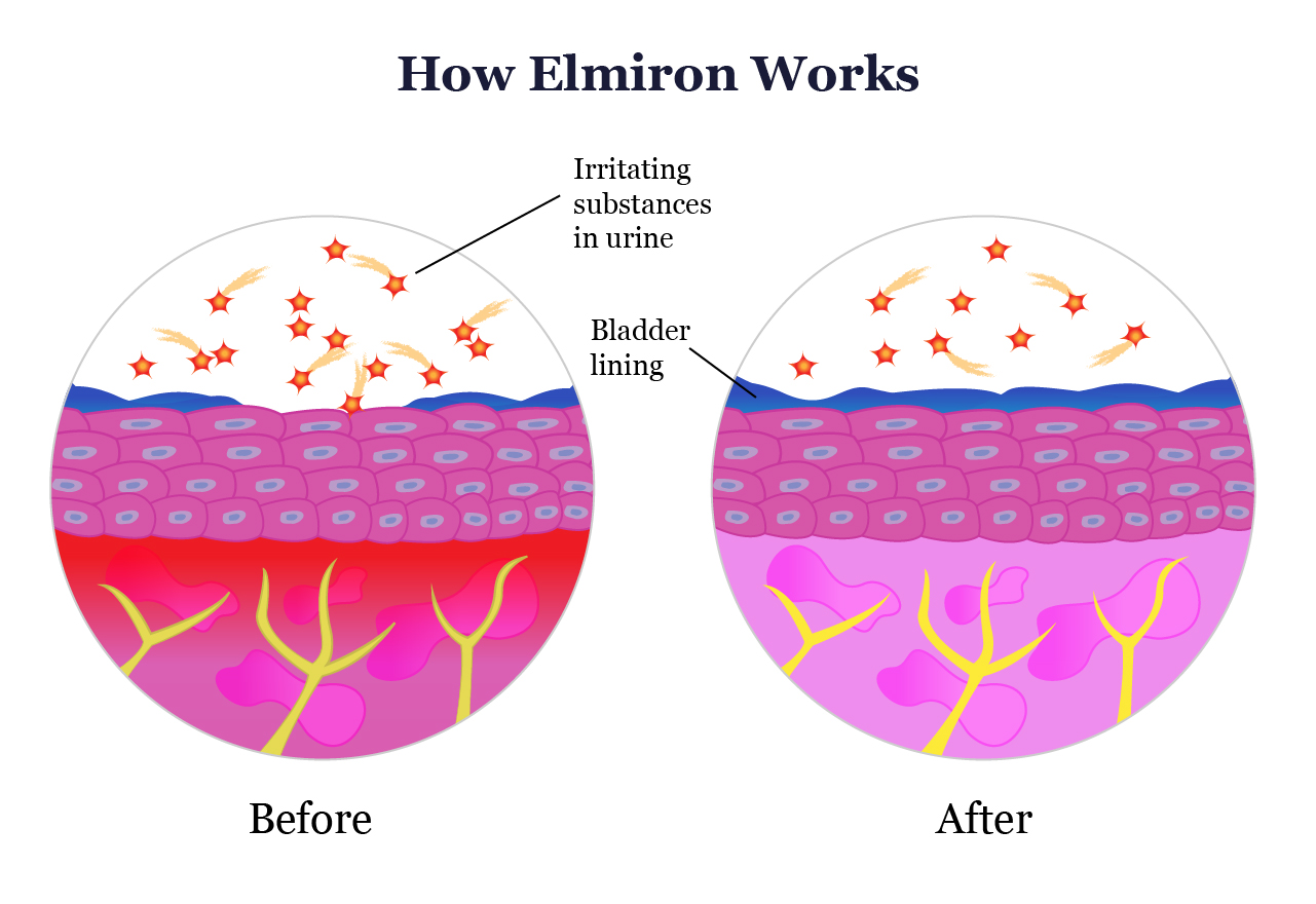 Elmiron | IC药物用量及副作用信息 - beplay外围下载,beplay体育中心下载